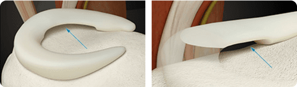 TREATMENTS - Justin Saliman MD